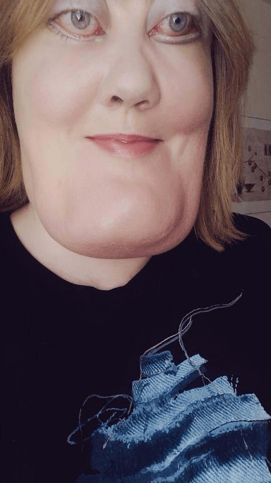 Victoria Wright’s extraordinary story: With her unique genetic ...