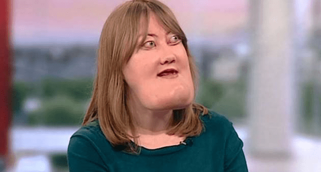 Victoria Wright’s extraordinary story: With her unique genetic ...