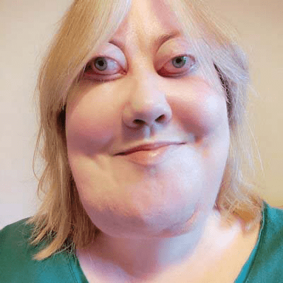 Victoria Wright’s extraordinary story: With her unique genetic ...