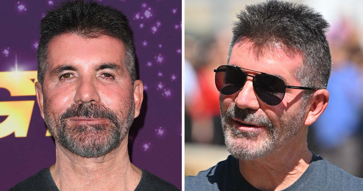 After the horrific accident, Simon Cowell thought he would never be ...
